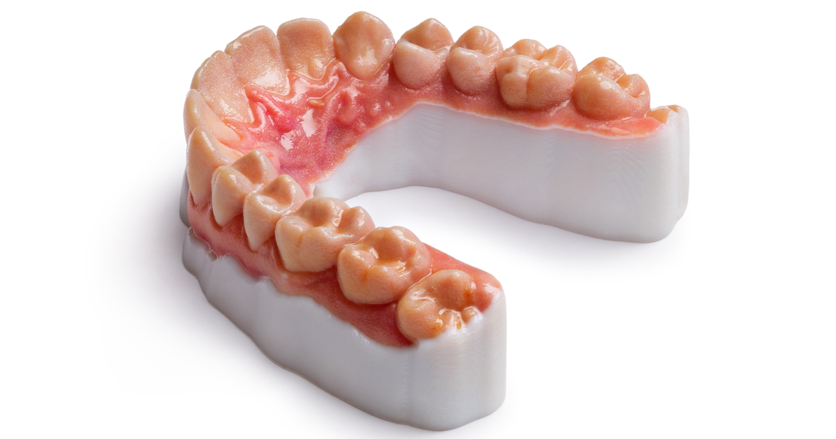 J5 DentaJet 3D printer full-color dental restorations