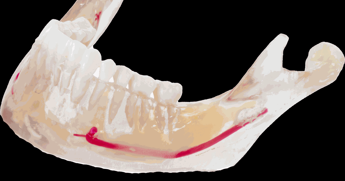 MED610 - PolyJet 소재 - Stratasys