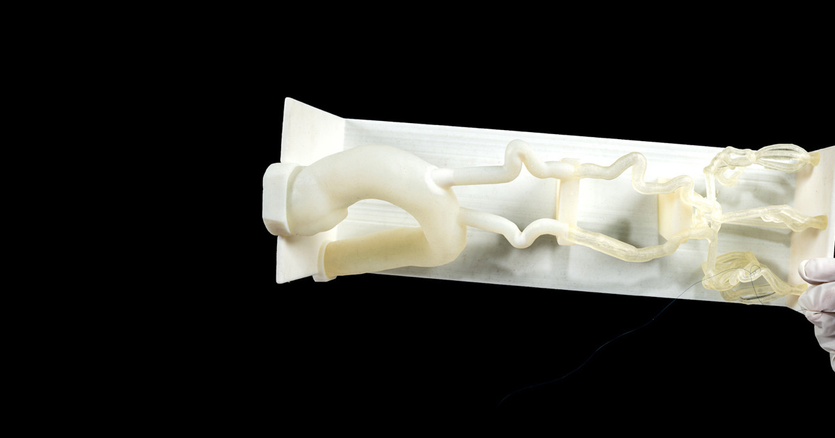 Revolutionizing Anatomical Model Creation with 3D Printing