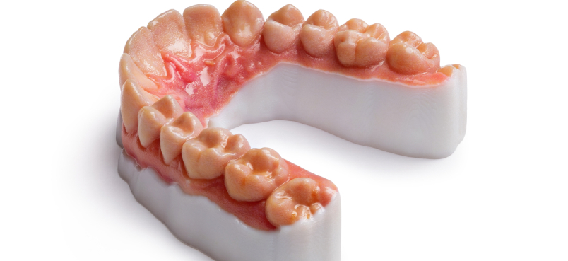 J5 DentaJet 3D printer full-color dental restorations